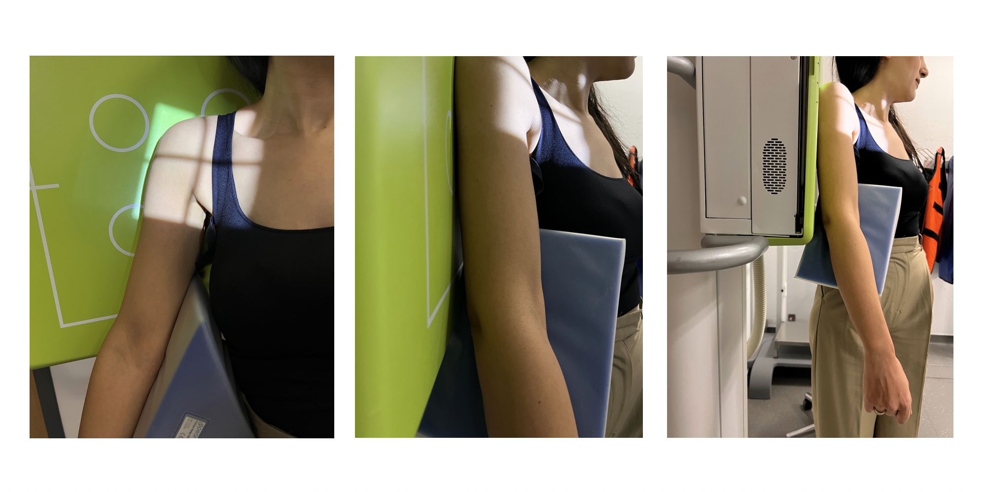 Shoulder X-ray - One joint, many possibilities