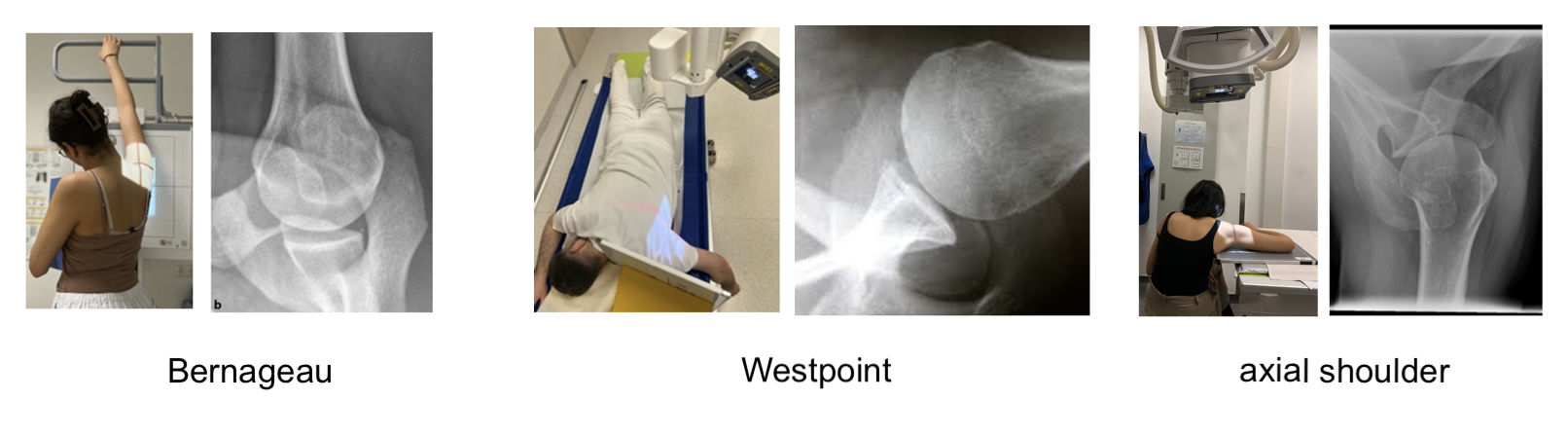 Shoulder X-ray - One joint, many possibilities