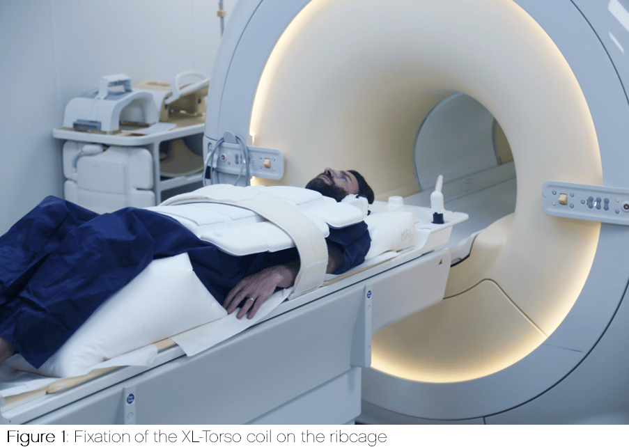 Case Study ProBelt-system