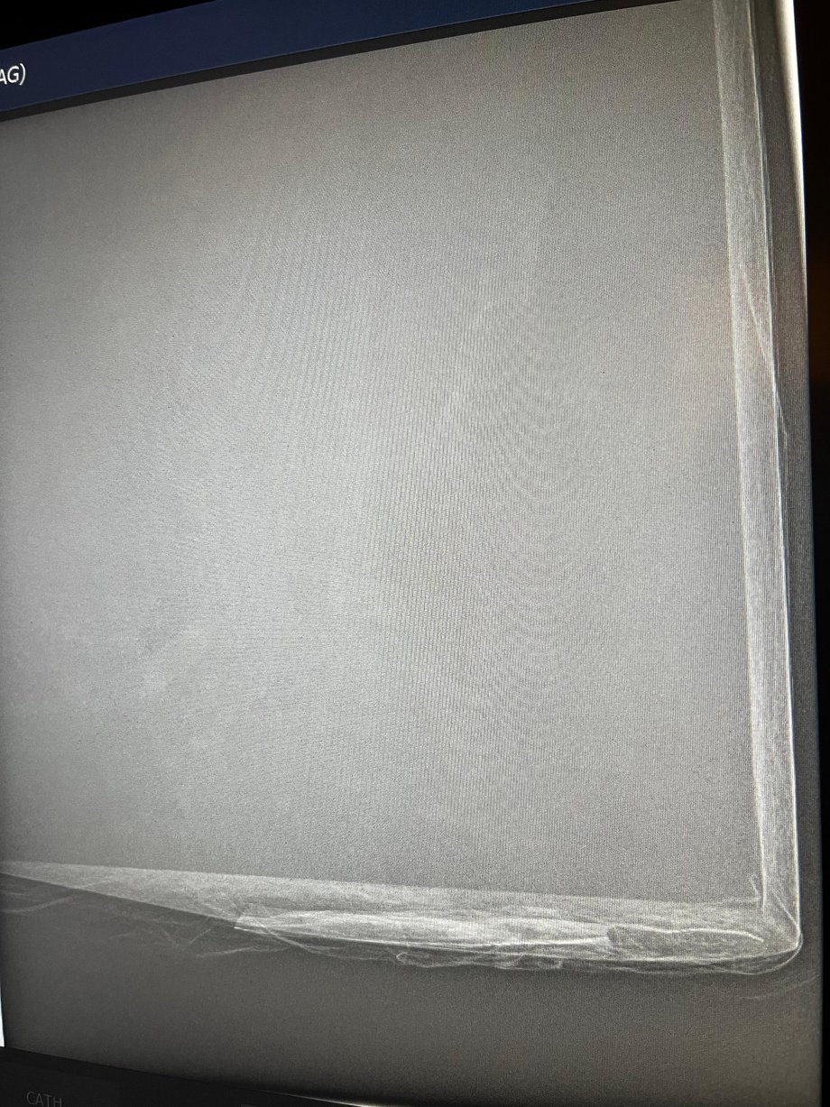 IMPORTANT CRITERIA FOR THE SELECTION OF SUITABLE POSITIONING AIDS