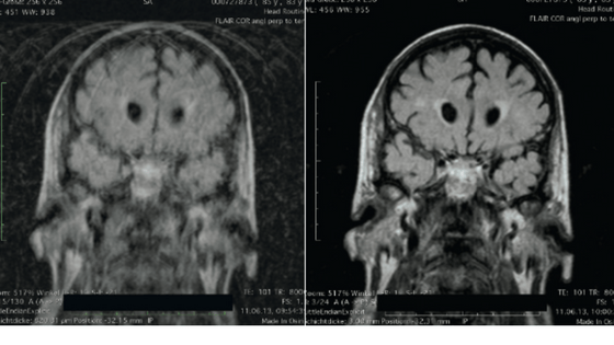 THE DOS & DON'TS OF PATIENT POSITIONING IN MRI