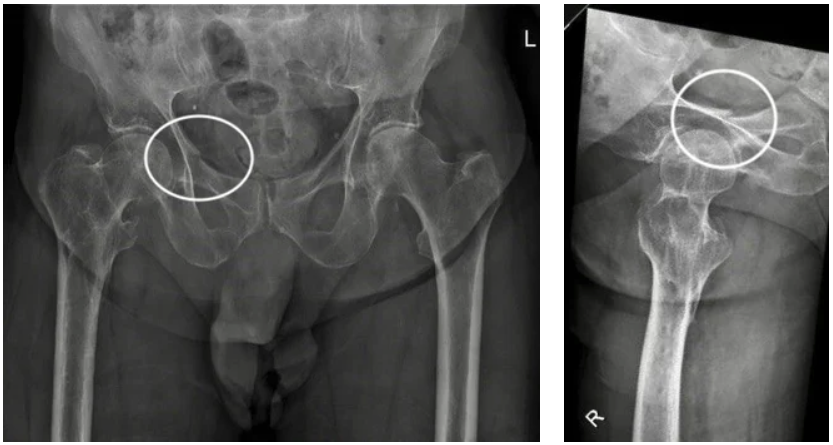 Einmal Lauenstein immer Lauenstein?