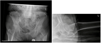 Einmal Lauenstein immer Lauenstein?