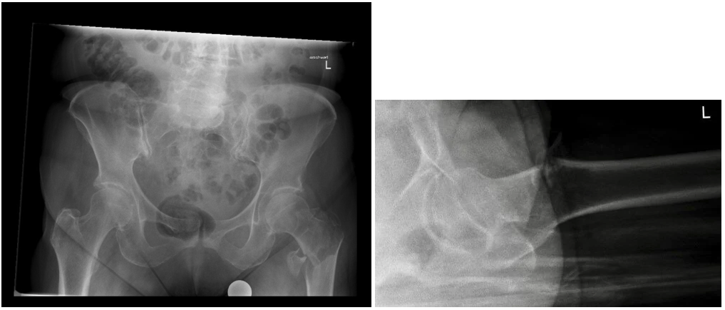 Einmal Lauenstein immer Lauenstein?