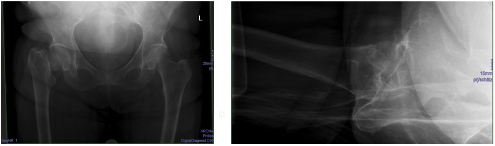 Einmal Lauenstein immer Lauenstein?
