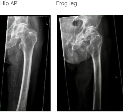 ONCE FROG LEG, ALWAYS FROG LEG?