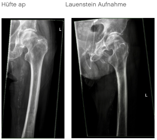 Einmal Lauenstein immer Lauenstein?