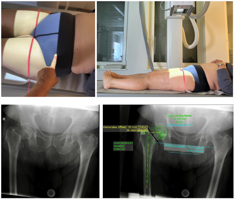 ONCE FROG LEG, ALWAYS FROG LEG?