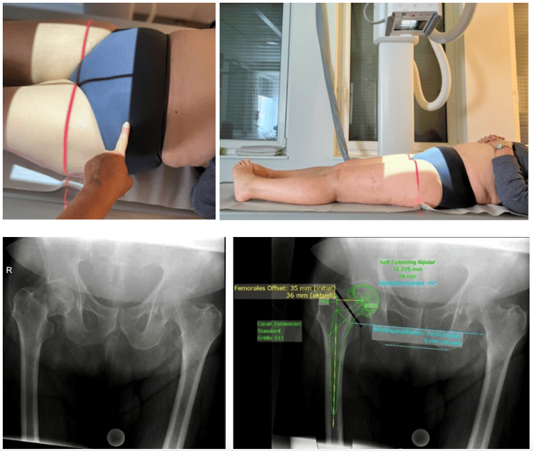 Einmal Lauenstein immer Lauenstein?