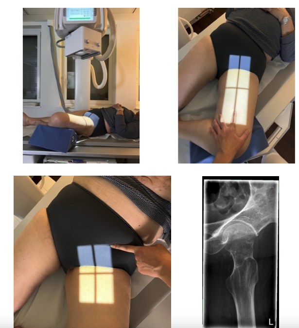 Einmal Lauenstein immer Lauenstein?