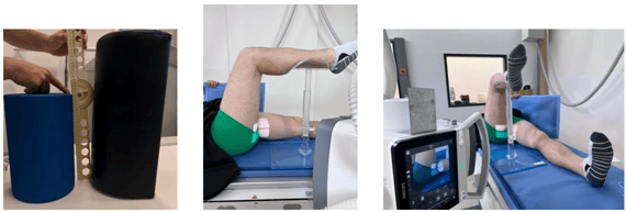 ONCE FROG LEG, ALWAYS FROG LEG?