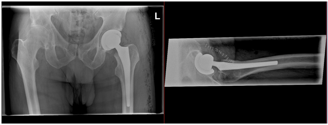 ONCE FROG LEG, ALWAYS FROG LEG?