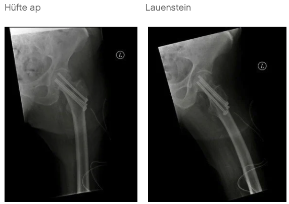Einmal Lauenstein immer Lauenstein?