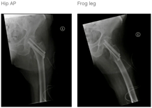 ONCE FROG LEG, ALWAYS FROG LEG?