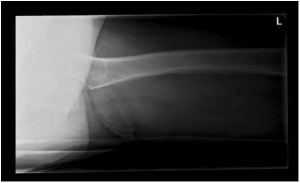 Einmal Lauenstein immer Lauenstein?