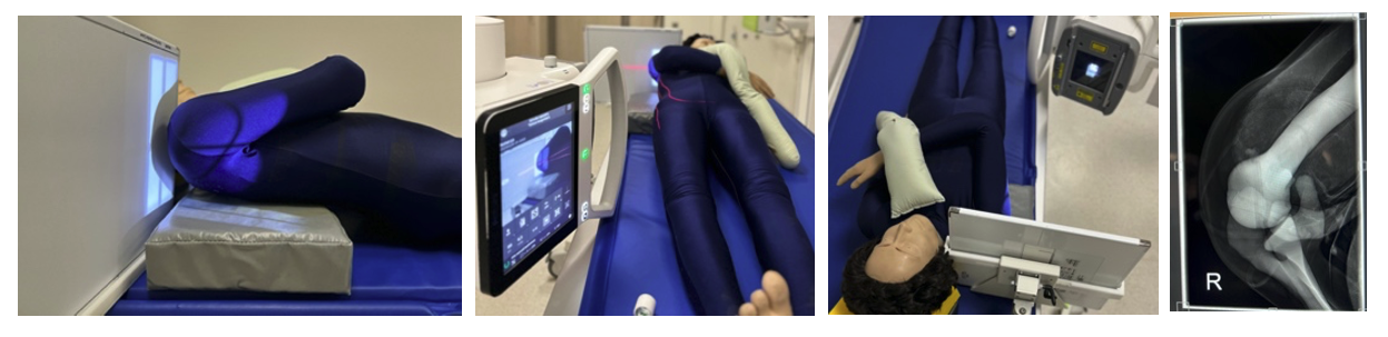 Shoulder X-ray - One joint, many possibilities
