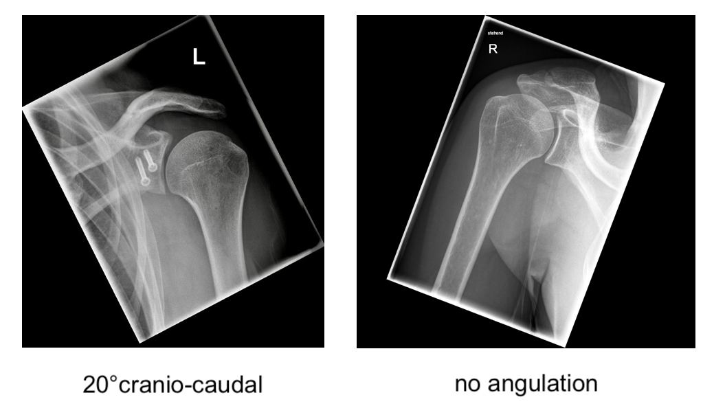 Shoulder X-ray - One joint, many possibilities