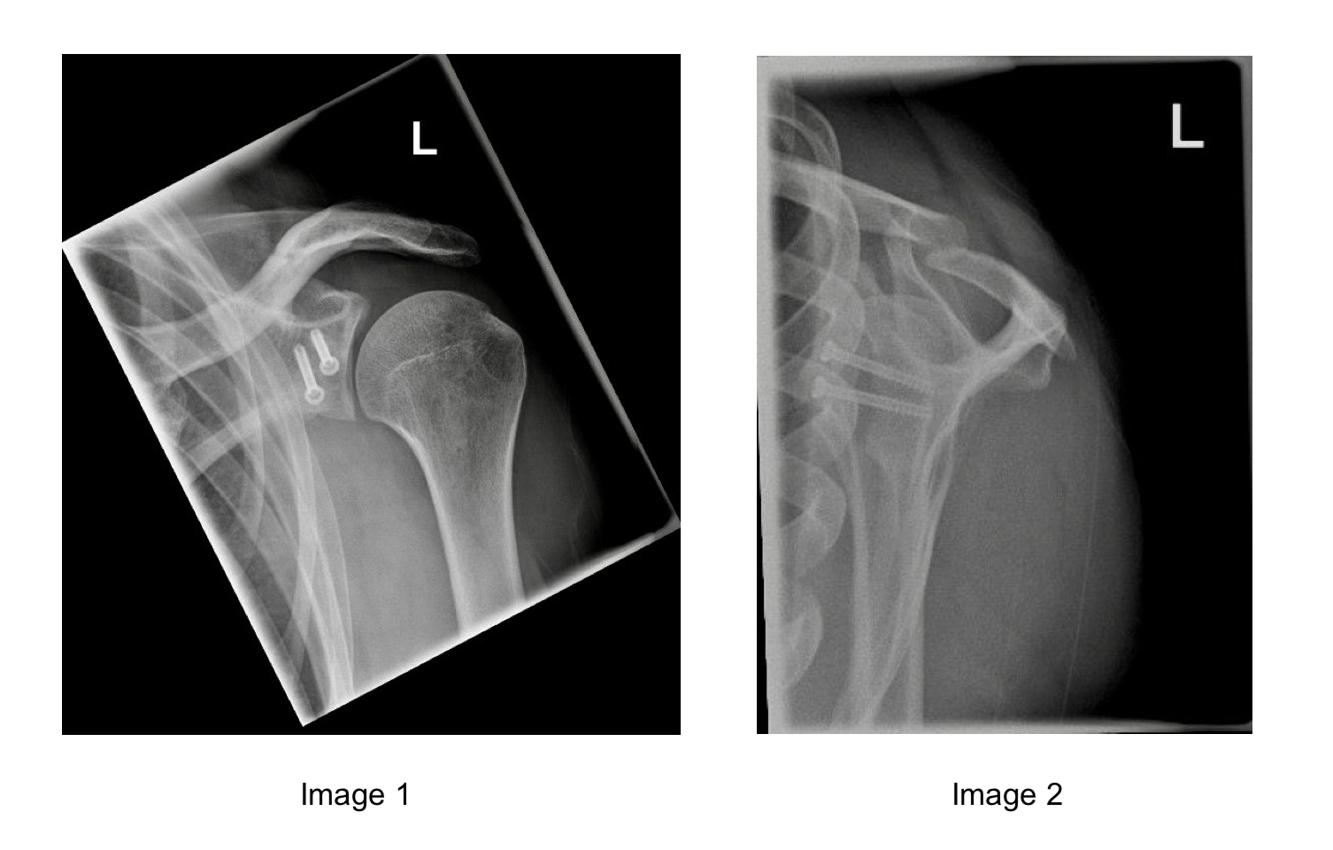 Shoulder X-ray - One joint, many possibilities