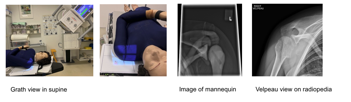 Shoulder X-ray - One joint, many possibilities
