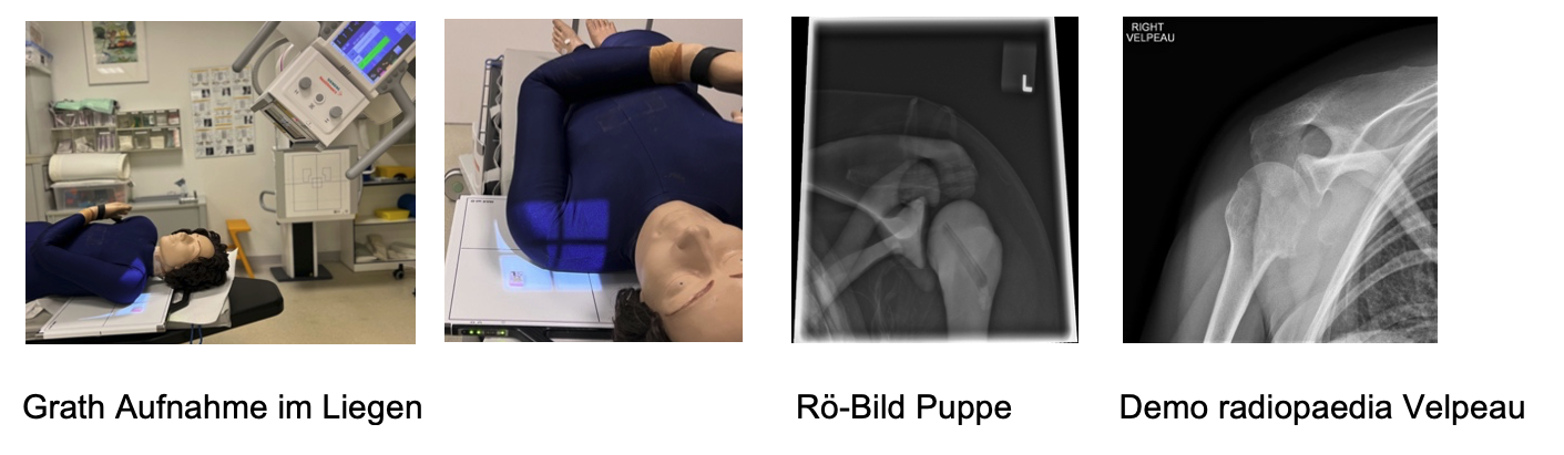 Schulter Röntgen – Ein Gelenk, viele Möglichkeiten