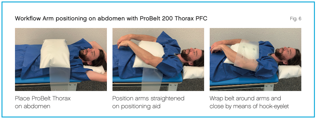 Arm positioning during Thorax/Abdomen CTs of motion-impaired Patients