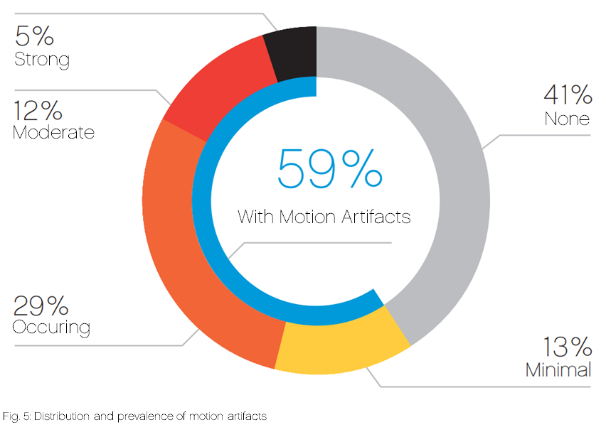 Motion artifacts in radiology: