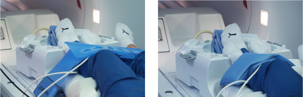 When MRI Positioning Gets Messy – Smart Tips That Actually Help