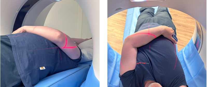 Tricky Patient Positioning in CT – Tipps by an Expert