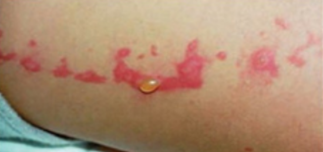 PATIENT PREPARATION, SCREENING AND POSITIONING