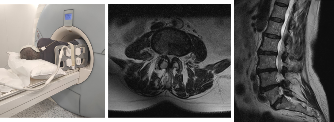 PATIENT PREPARATION, SCREENING AND POSITIONING