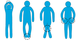 THE DOS & DON'TS OF PATIENT POSITIONING IN MRI